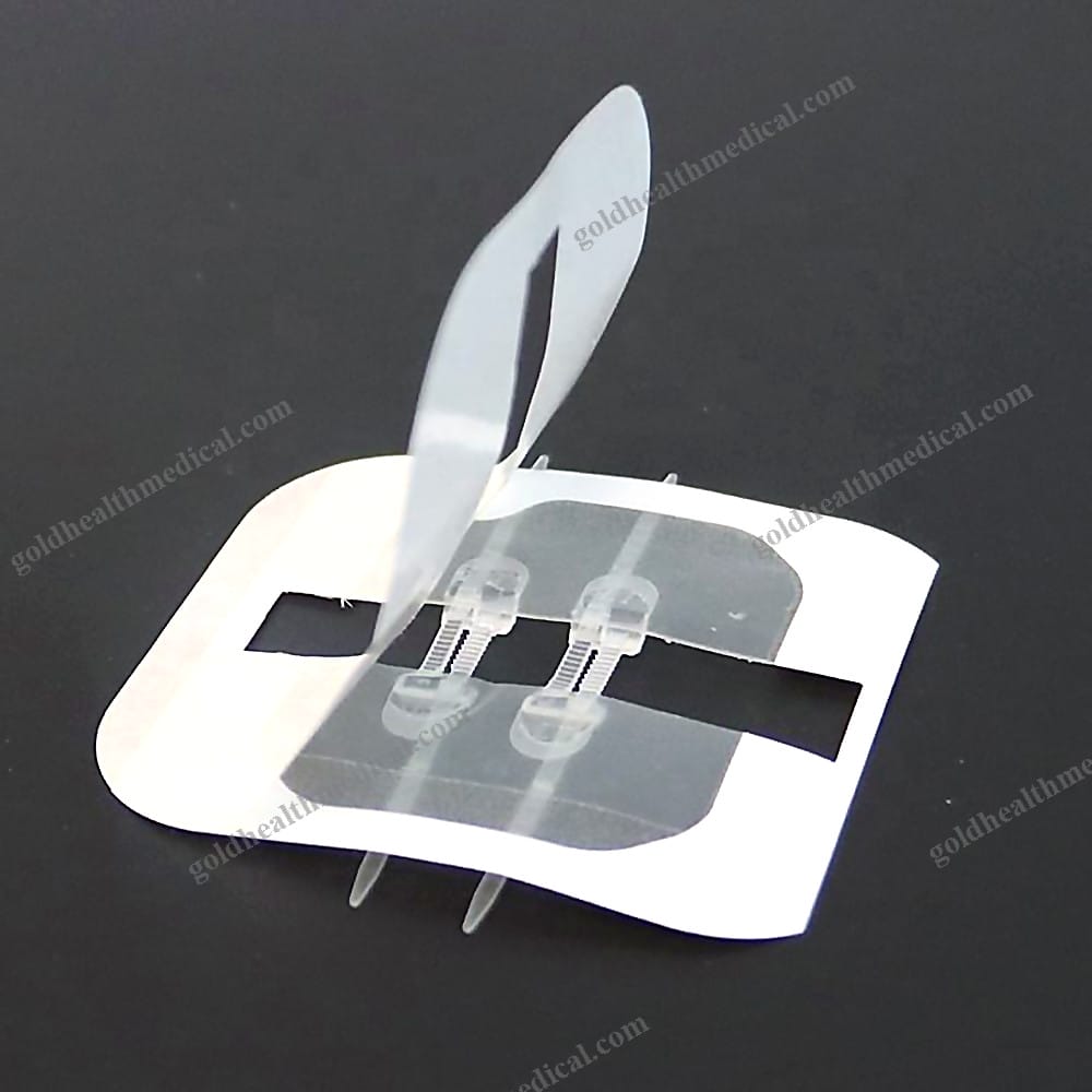 Durable BLUENJOY Medical Transparent Zip Stitch Wound Closure Device ...