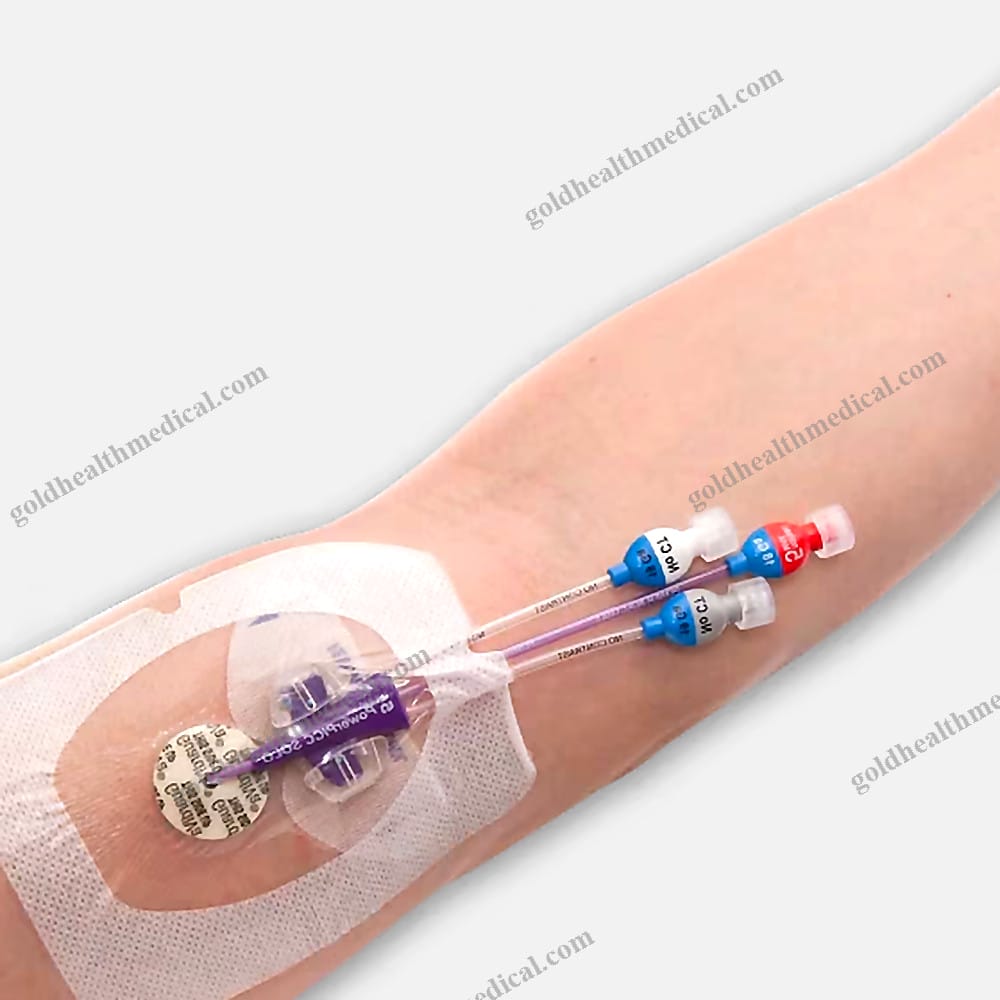 Durable UNIMASTER IV Cannula Dressing Fixator Surgical Transparent ...