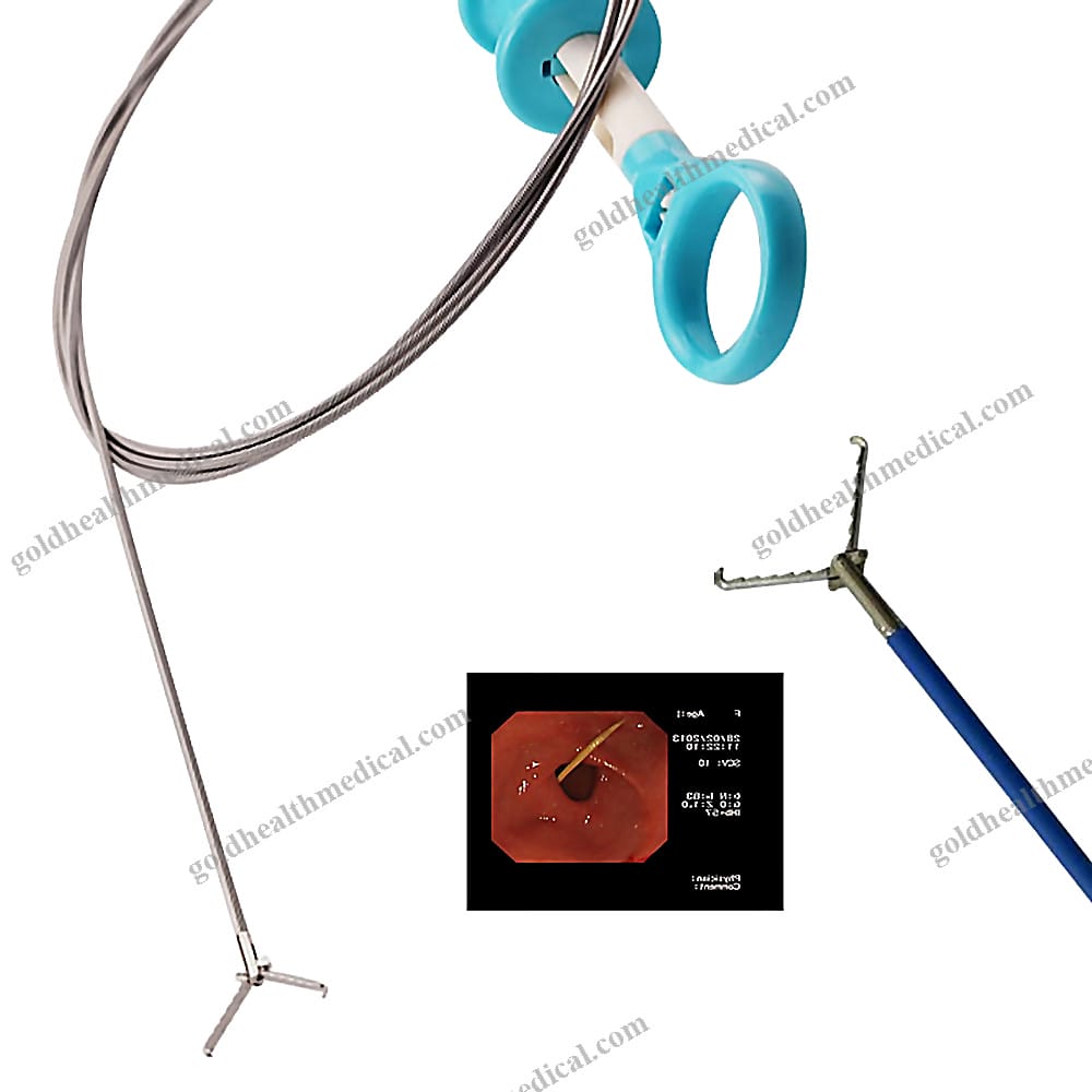 Durable Flexible Urology Forceps for Endoscopic Foreign Body Grasping ...