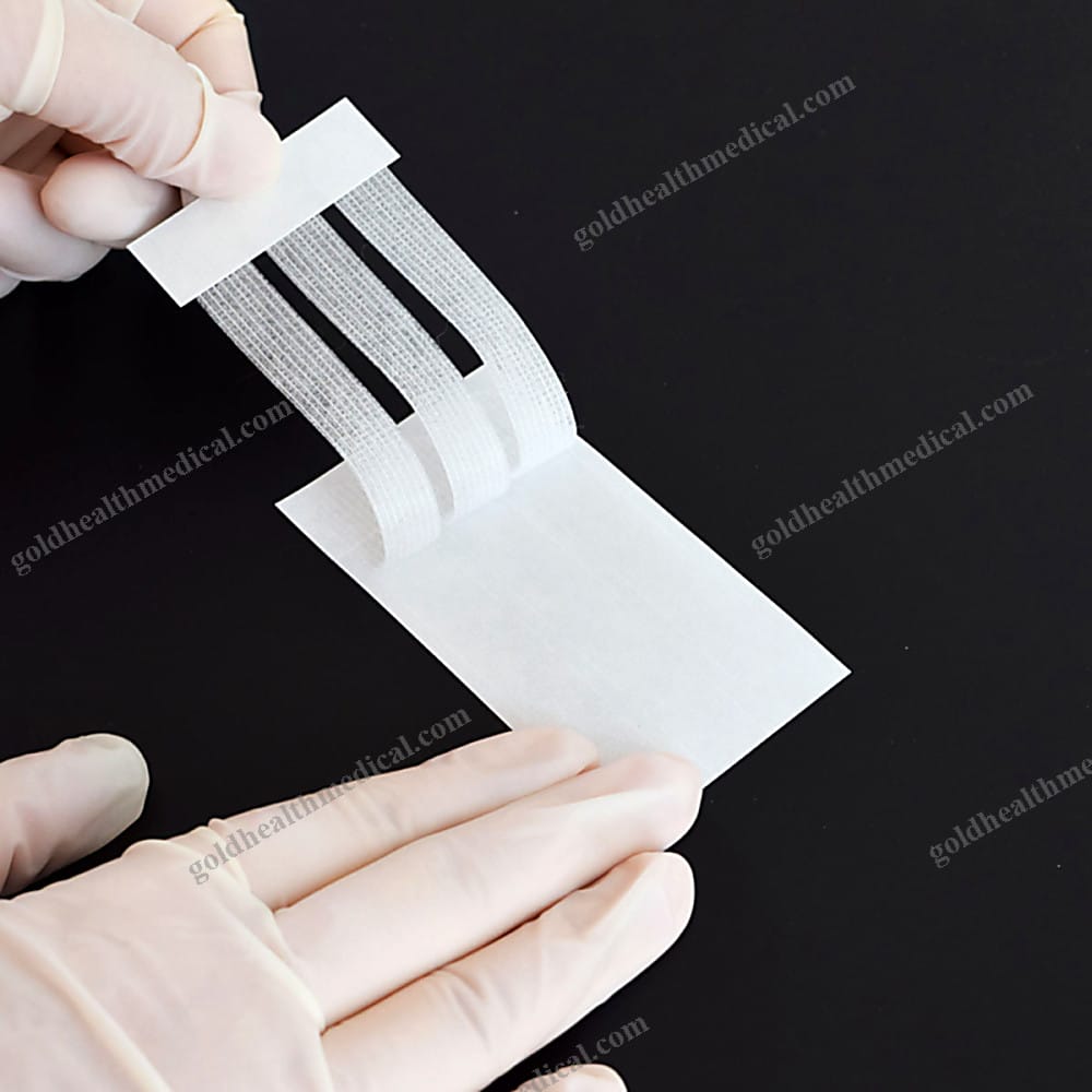 Durable Advanced Skin Closure Strips for Wound Care Solutions Sale or ...